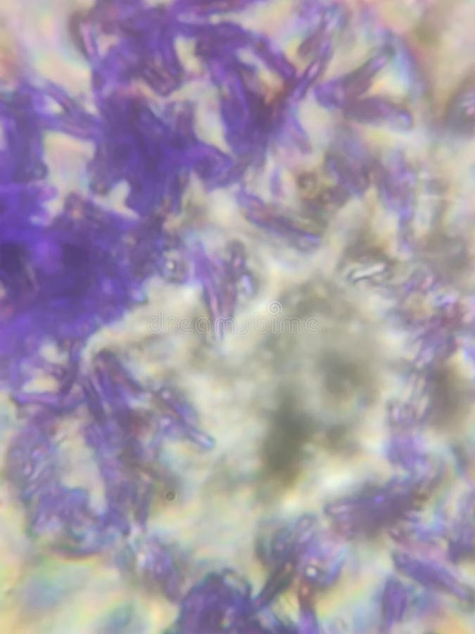 Bacteria Growing on an Agar Plate. Stock Image - Image of education ...