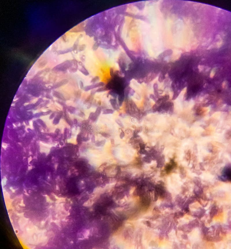 Bacteria Growing on Decaying Beet Stock Image - Image of biology ...