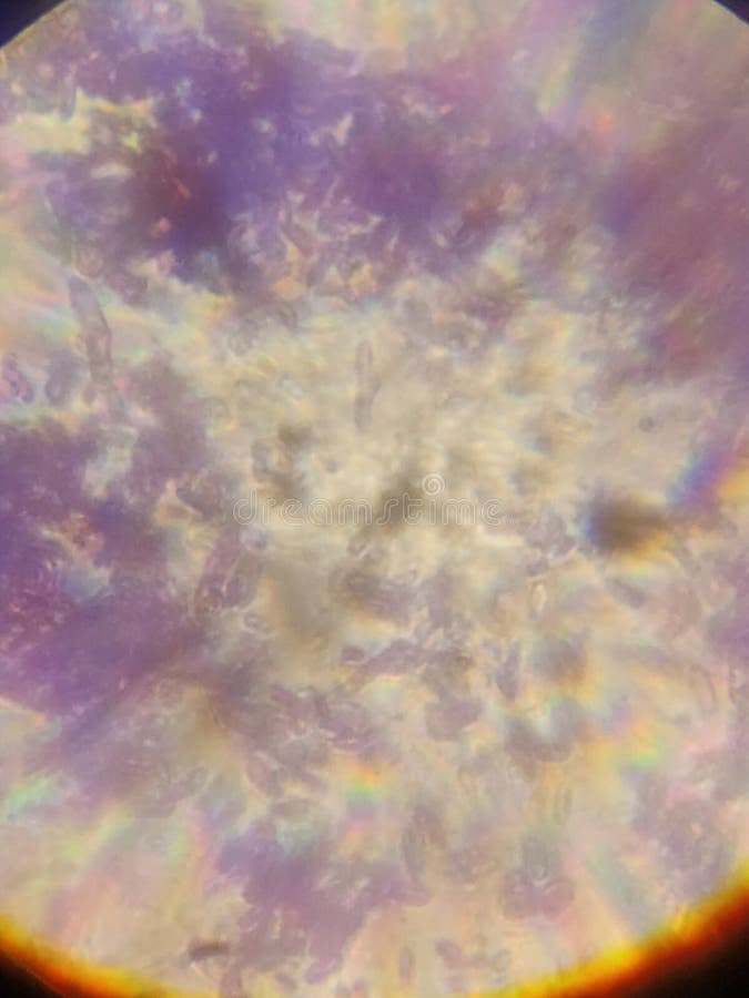 Bacteria Growing on Decaying Beet Stock Photo - Image of science ...