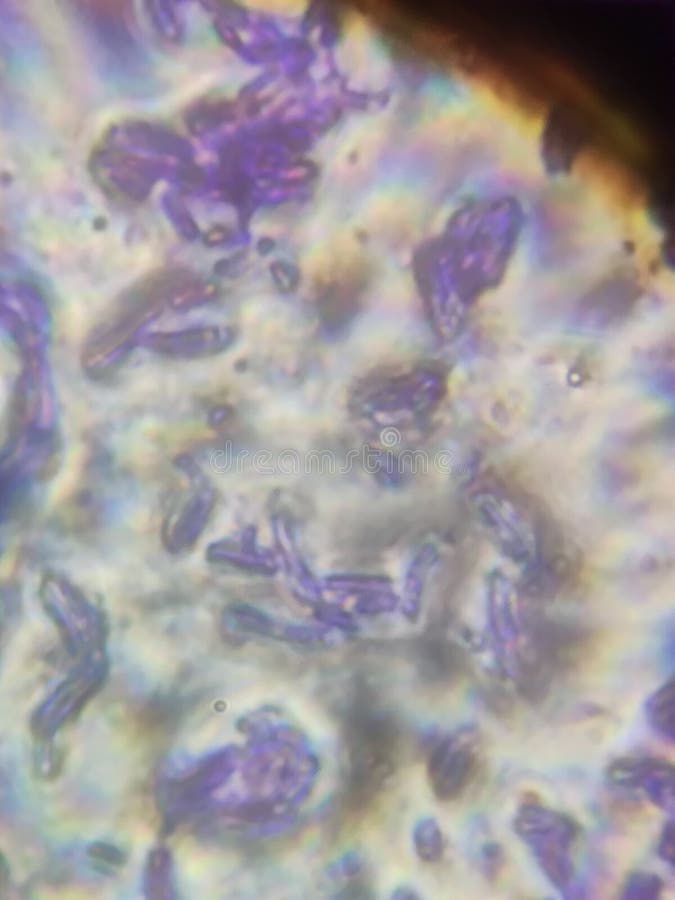 Bacteria Growing on Decaying Beet Stock Image - Image of bacteria ...