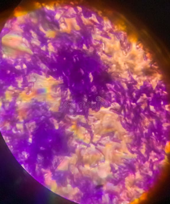 Bacteria Growing on Decaying Beet Stock Photo - Image of beet, vulgaris ...