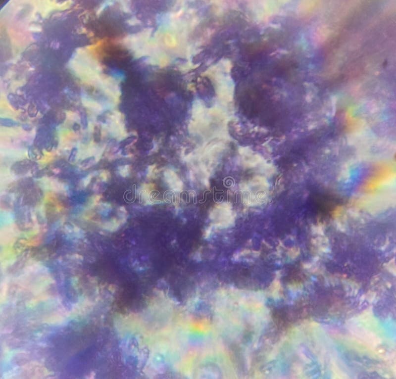 Bacteria Growing on Decaying Beet Stock Photo - Image of microbiology ...