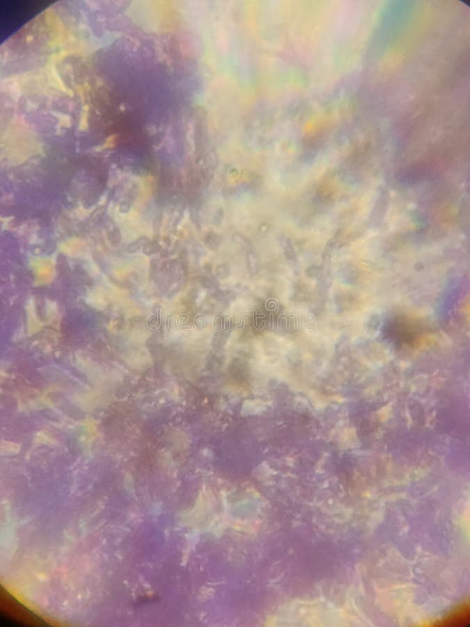 Bacteria Growing on Decaying Beet Stock Image - Image of beta, decaying ...