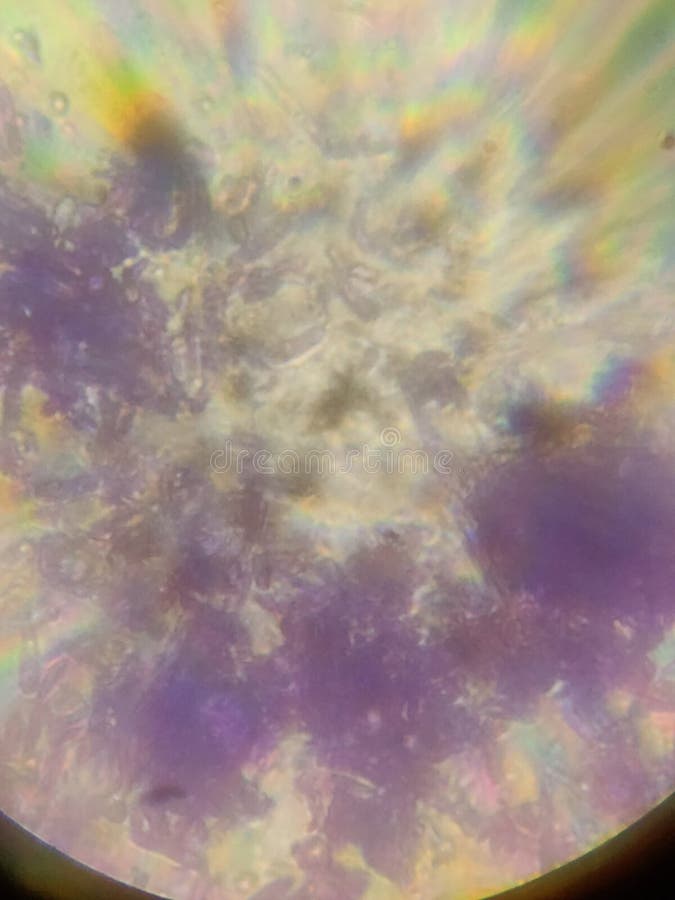 Bacteria Growing on Decaying Beet Stock Image - Image of microbiology ...