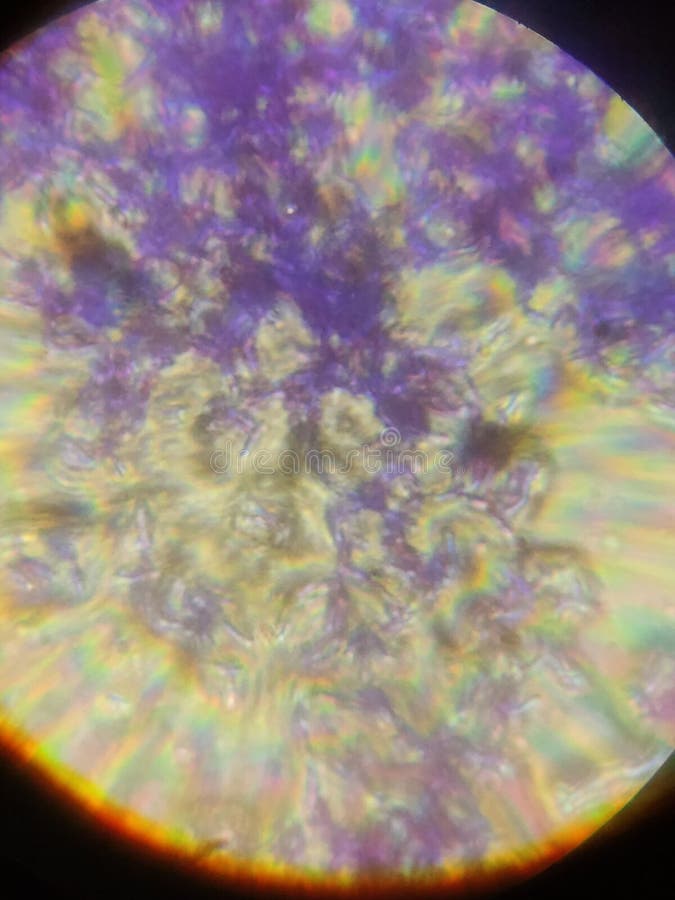 Bacteria Growing on Decaying Beet Stock Image - Image of science ...