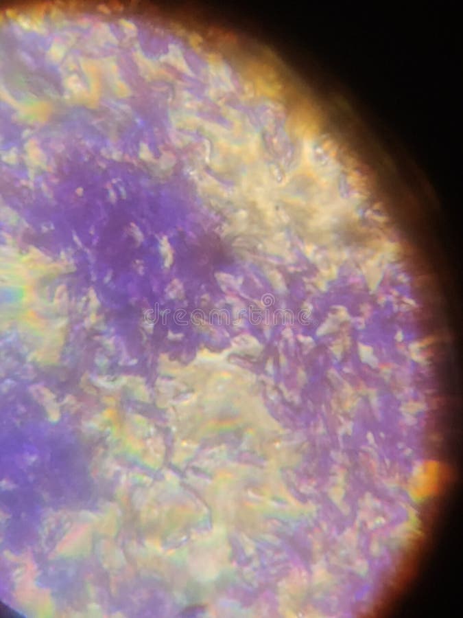 Bacteria Growing on Decaying Beet Stock Image - Image of bacteria ...