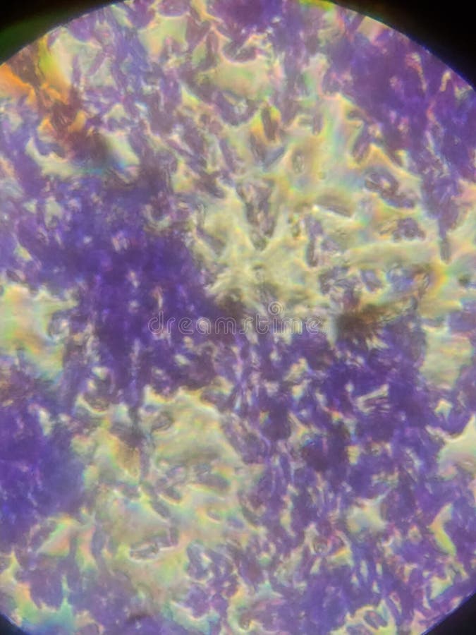 Bacteria Growing on Decaying Beet Stock Photo - Image of bacteria ...