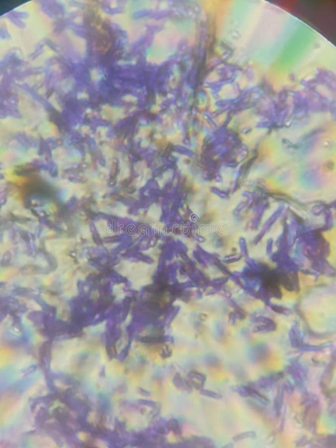 Bacteria Growing on Decaying Beet Stock Photo - Image of vulgaris ...