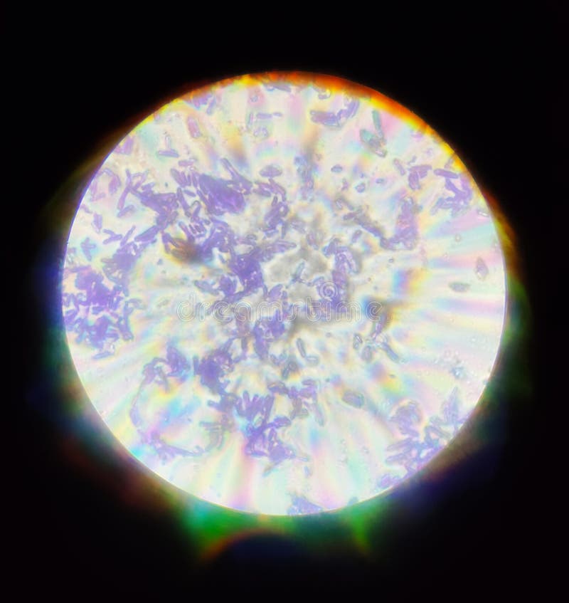 Bacteria Growing on Decaying Beet Stock Photo - Image of beta, vulgaris ...