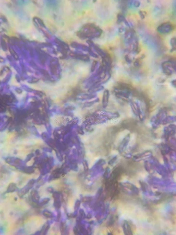 Bacteria Growing on Decaying Beet Stock Photo - Image of biology ...