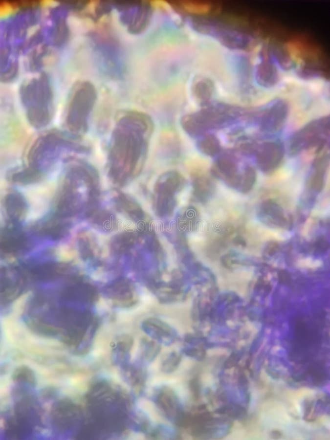 Bacteria Growing on Decaying Beet Stock Photo - Image of microscopy ...