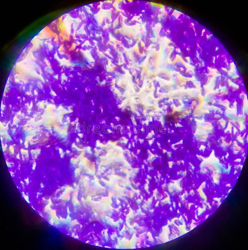 Bacteria Growing on Decaying Beet Stock Image - Image of microbiology ...