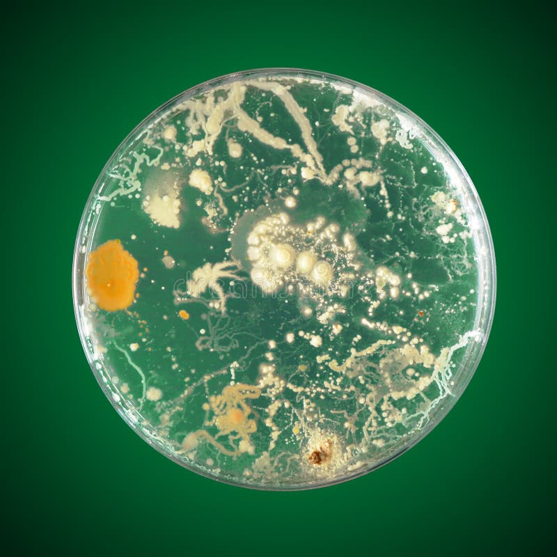 Yellow Bacteria Colonies on a Petri Plate Stock Photo - Image of ...