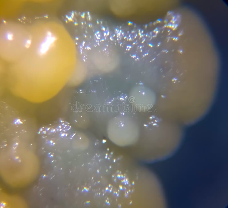 Microscopy of a Smooth Round Bacterial Colonies Stock Image - Image of ...