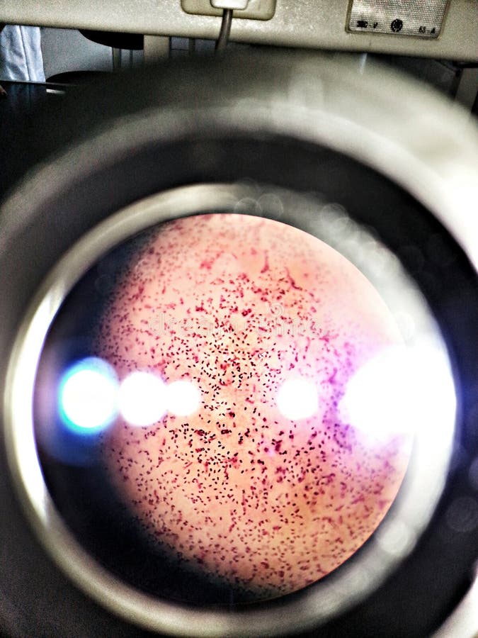 Bacteria Image on Microscope Stock Image - Image of microscobic, campus ...