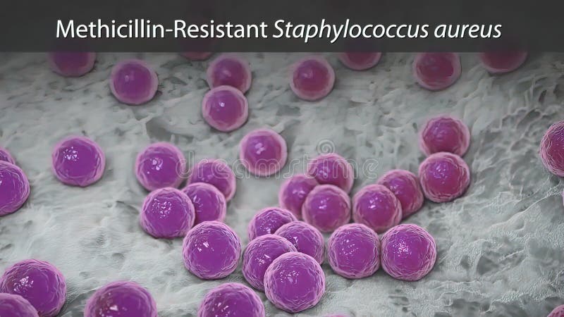 Bacteria Infecting the Body Stock Illustration - Illustration of ...