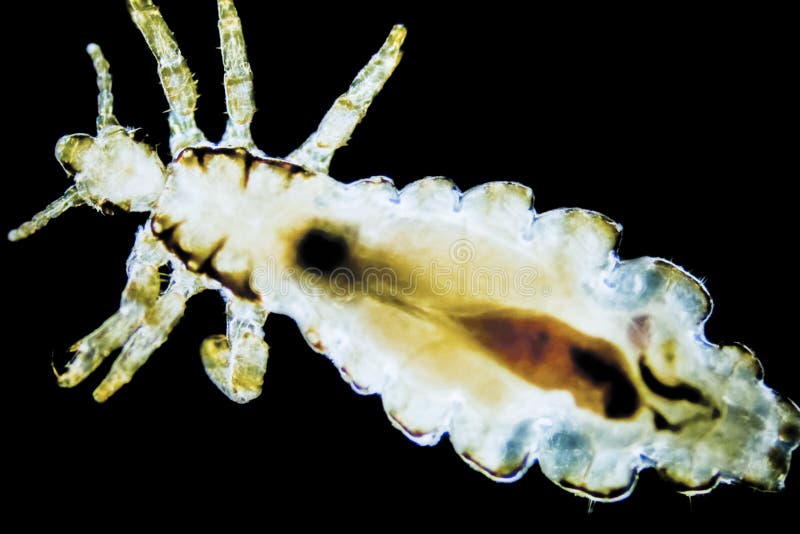 Head Louse stock image. Image of childs, insect, blood - 25439011