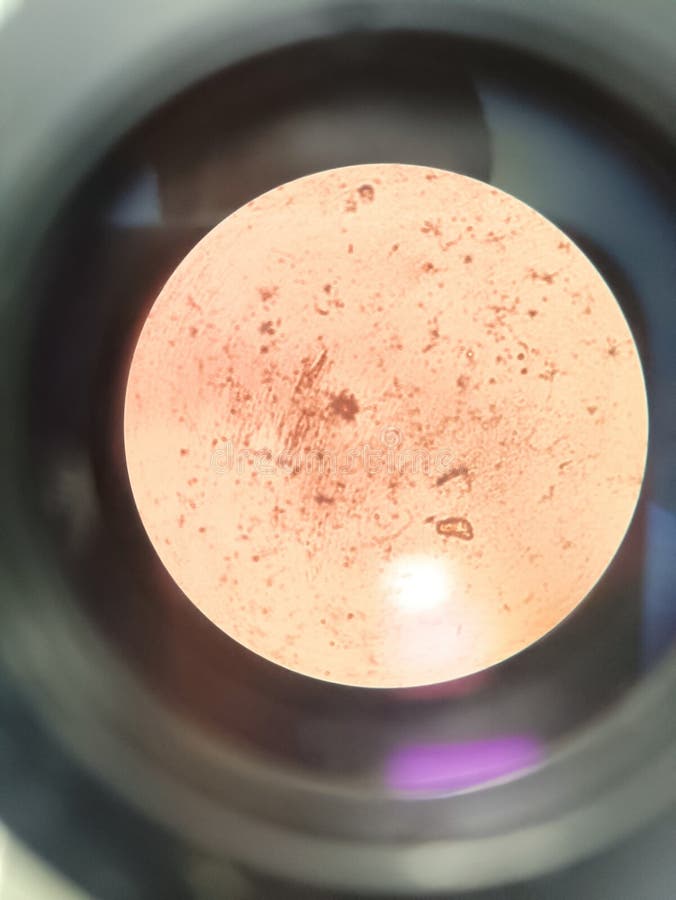 Bacteria Research Using a Microscope in the Laboratory Stock Photo ...