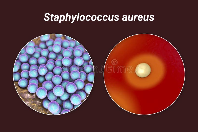 Bacteria Staphylococcus Aureus, 3D Illustration Stock Illustration ...