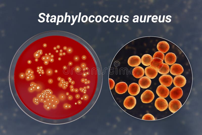 Bacteria Staphylococcus Aureus, 3D Illustration Stock Illustration ...