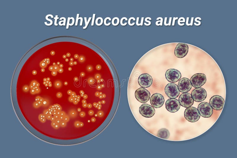 Bacteria Staphylococcus Aureus, 3D Illustration Stock Illustration ...