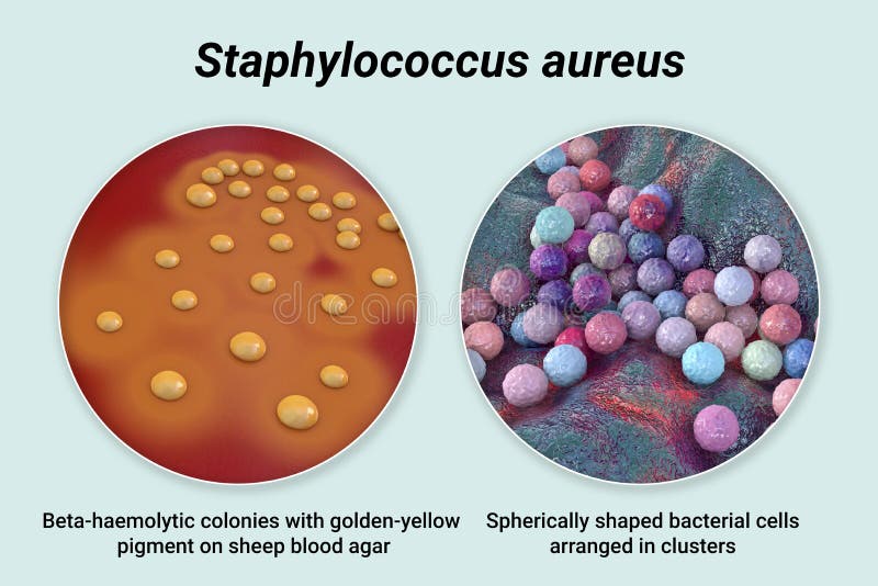 Bacteria Staphylococcus Aureus, 3D Illustration Stock Illustration ...