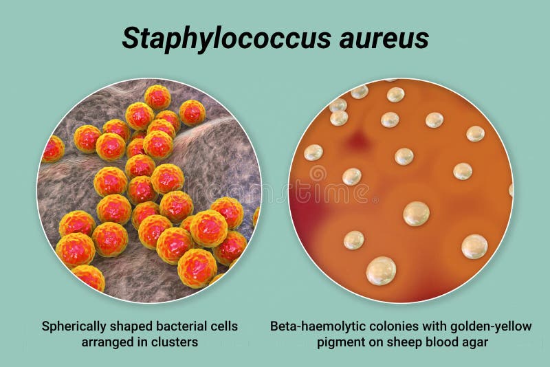 Bacteria Staphylococcus Aureus, 3D Illustration Stock Illustration ...