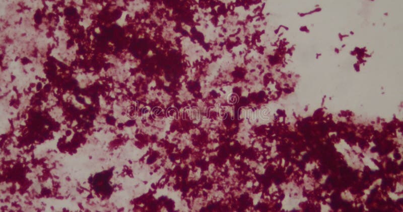 Bacteria Under a Microscope in a Hospital Stock Footage - Video of ...