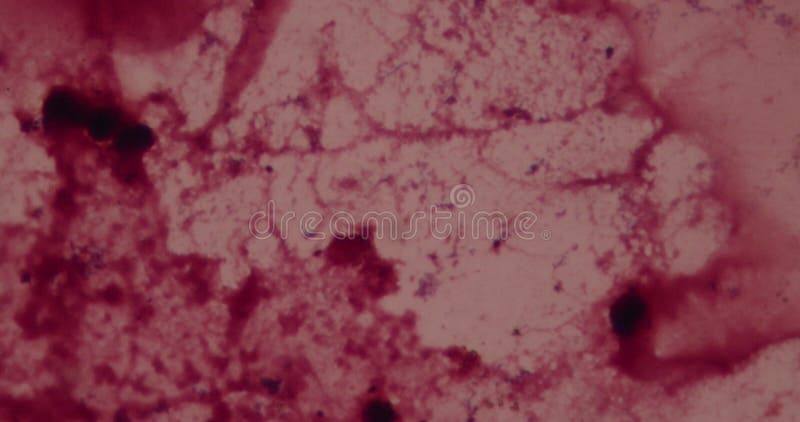 Bacteria Under a Microscope in a Hospital Stock Footage - Video of ...