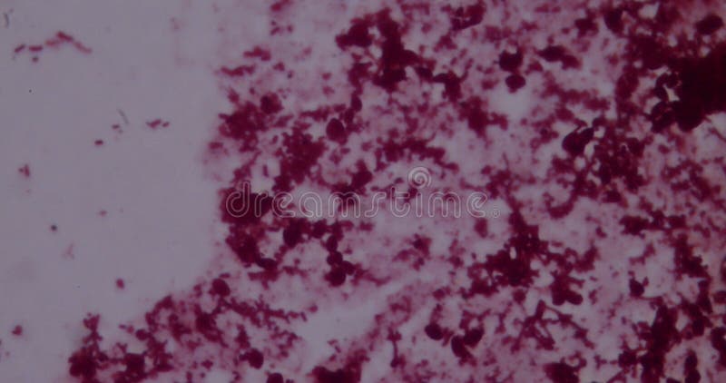 Bacteria Under a Microscope in a Hospital Stock Footage - Video of ...