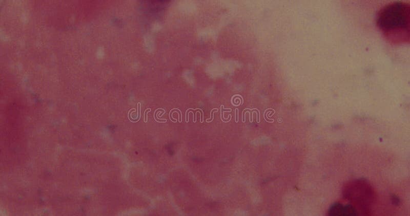 Bacteria Under a Microscope in a Hospital Stock Video - Video of ...