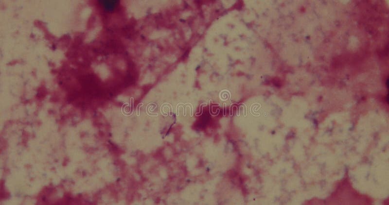 Bacteria Under a Microscope in a Hospital Stock Video - Video of ...