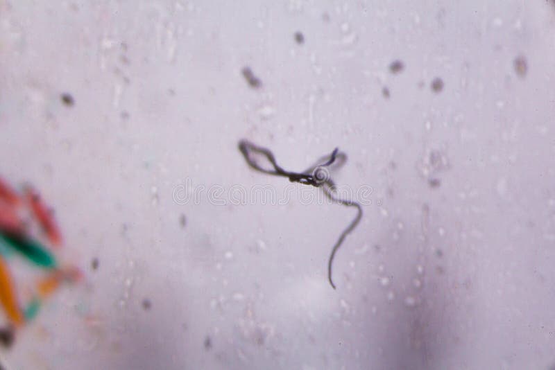 Bacteria Under the Microscope Stock Photo - Image of flagella ...