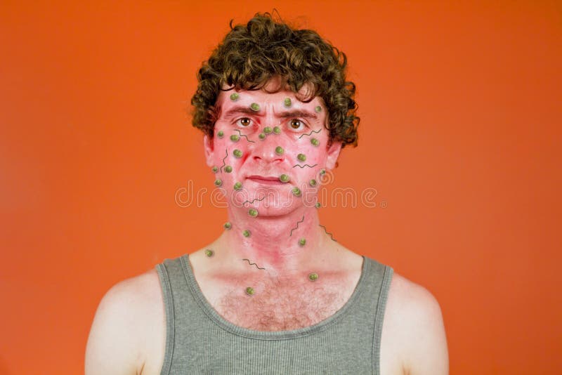 Bacteria Virus Face stock photo. Image of male, problem - 62555880