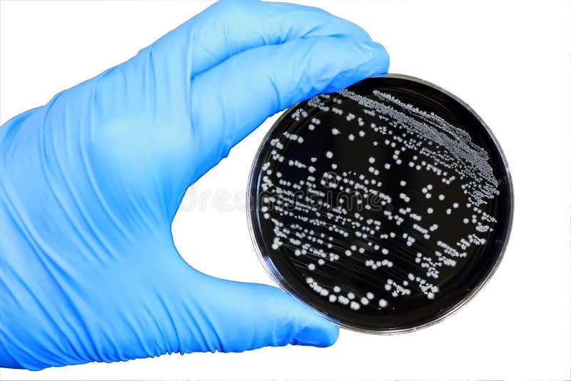 Bacterial colonies stock image. Image of morphology, science - 4348699