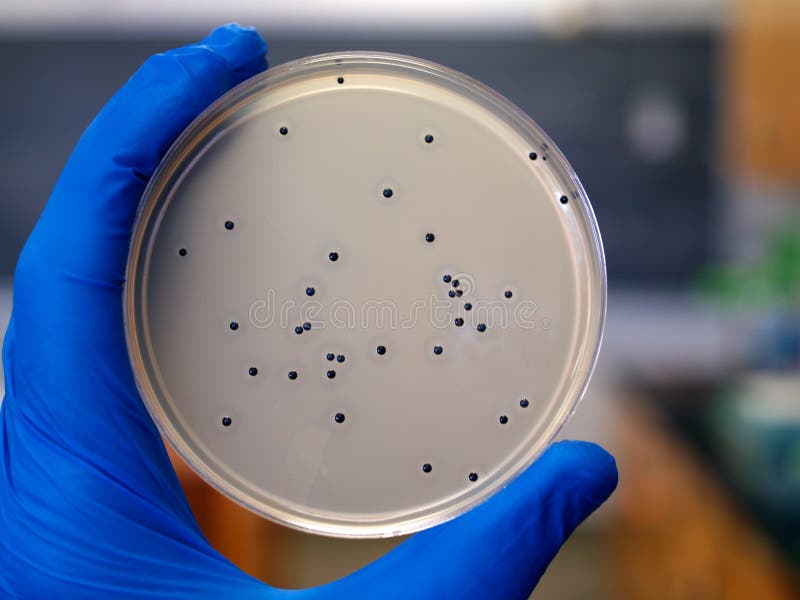 Bacterial colonies stock image. Image of morphology, science - 4348699
