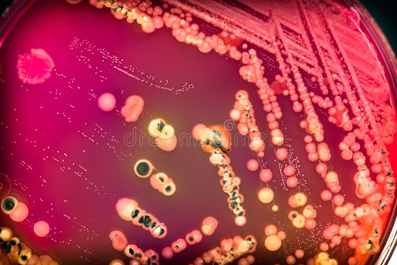 Bacterial Colonies Culture on Selective Agar Media(SS Agar). Stock ...