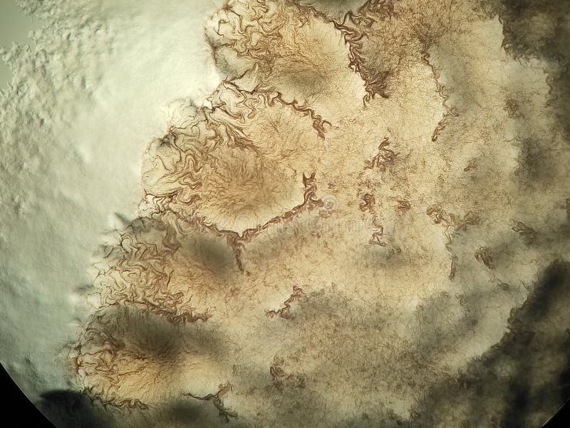 Microscope View of Bacillus and Other Bacteria Bacteria Growing in ...