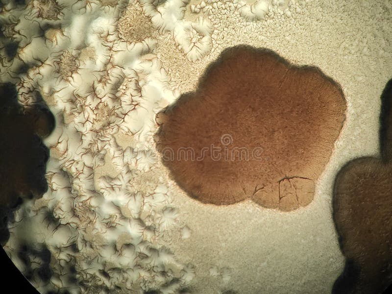 Microscope View of Bacillus and Other Bacteria Bacteria Growing in ...