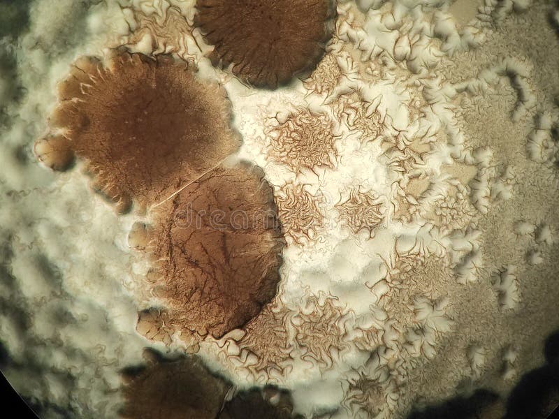 Microscope View of Bacillus and Other Bacteria Bacteria Growing in ...