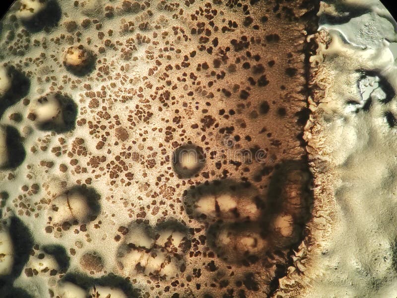 Microscopy Of A Bacterial Colony Stock Image - Image of bacterial ...