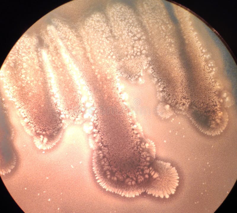 Growing Microorganisms Culture on the Disk. Stock Image - Image of ...