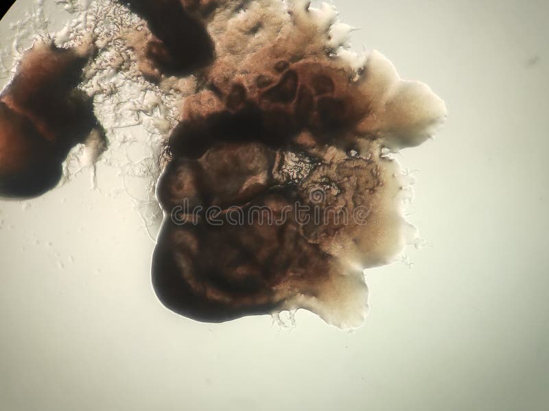Microscope View of a Bacterial Colonies Stock Image - Image of growing ...