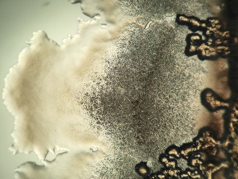 Bacterial Colony in a Petri Dish, Microscope View Stock Image - Image ...
