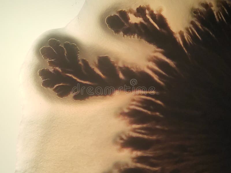 Bacterial Colony Microscopy Stock Image - Image of microbiology ...