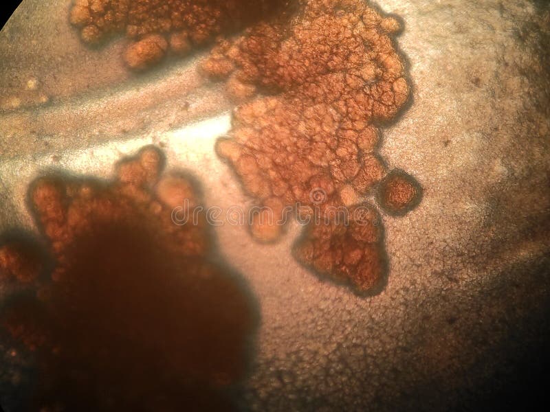 Penicilium Mold Colonies Growing from a Contamination on Saboraud ...