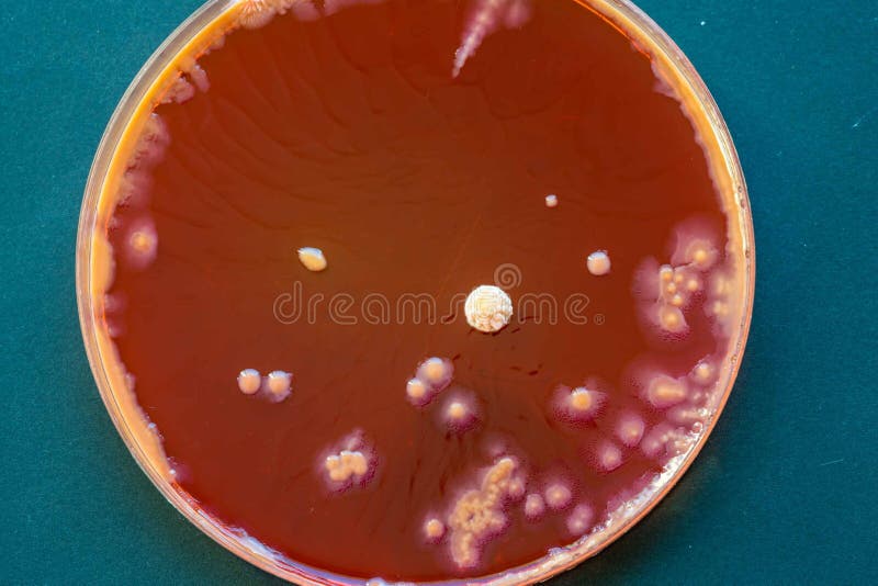Bacterial Culture on Red Agar Stock Image - Image of growth, bacteria ...
