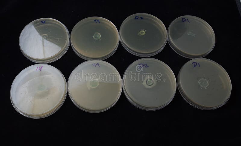 562 Bacterial Parasite Stock Photos - Free & Royalty-Free Stock Photos ...