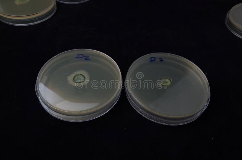 562 Bacterial Parasite Stock Photos - Free & Royalty-Free Stock Photos ...