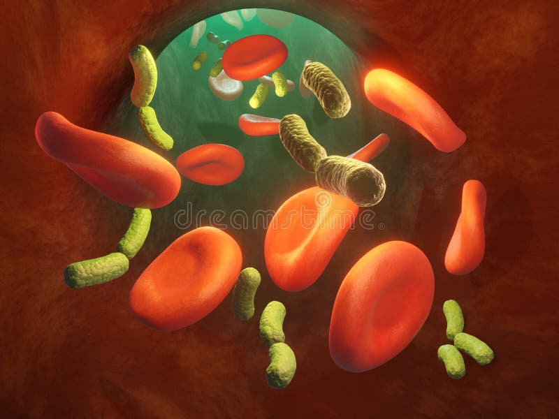 Bacterial Infection in Blood Stream Stock Illustration - Illustration ...